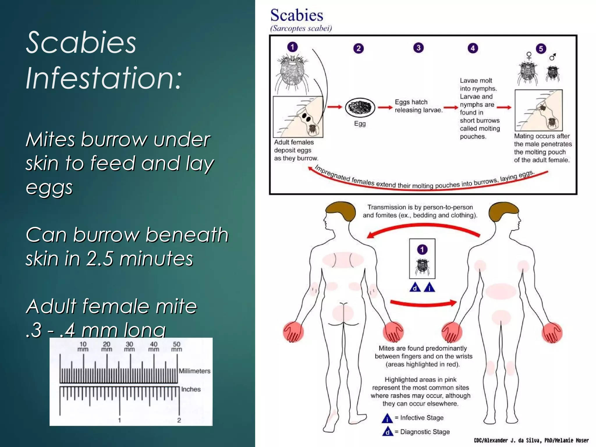 A short guide to scabies treatment 2016 | PPT
