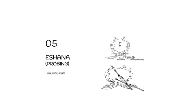 Ashthavidha Shastra karma according to acharya sushruta | PPTX