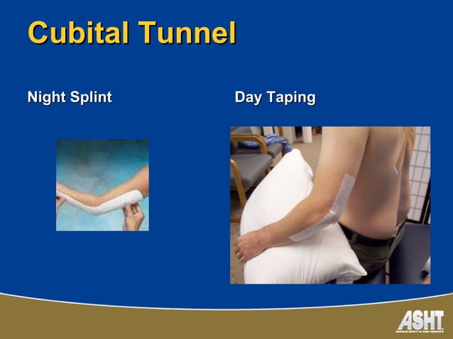 Asht-ca chapter splinting | PPT