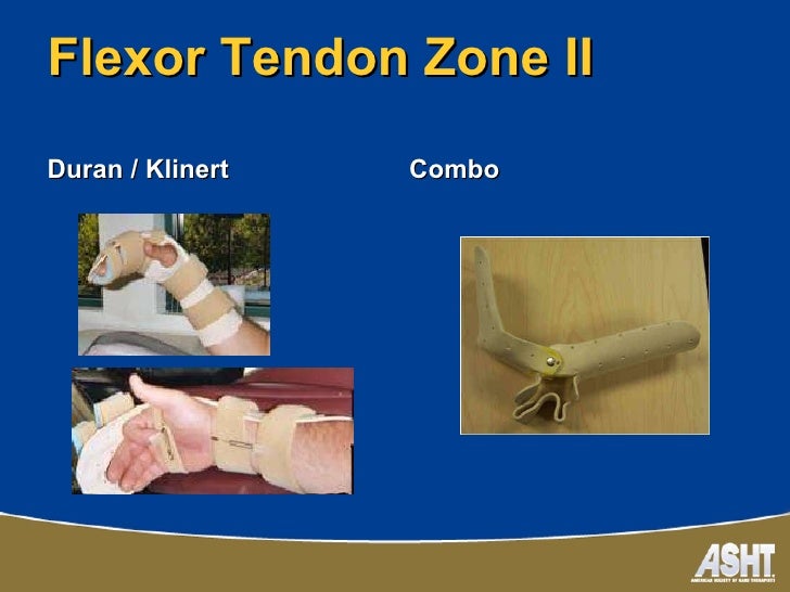 Asht-ca chapter splinting