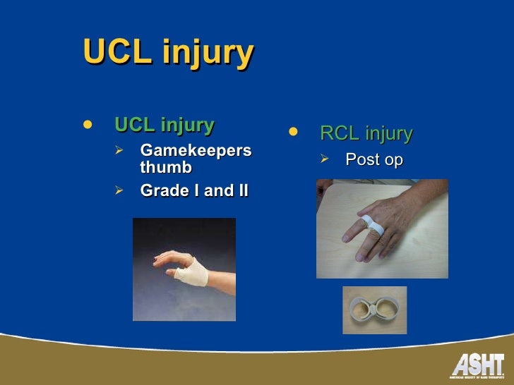 Asht-ca chapter splinting