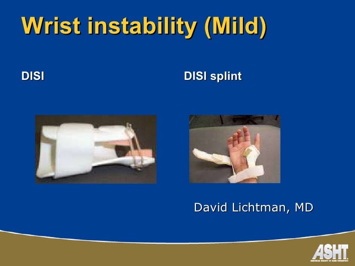 Asht-ca chapter splinting