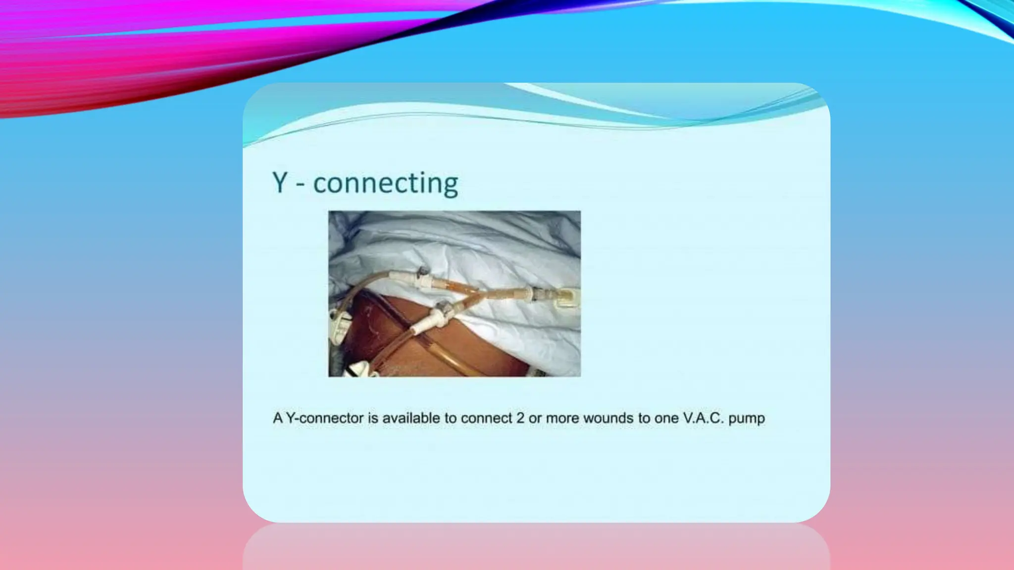 Vacuum asssited wound therapy for buns management | PPT