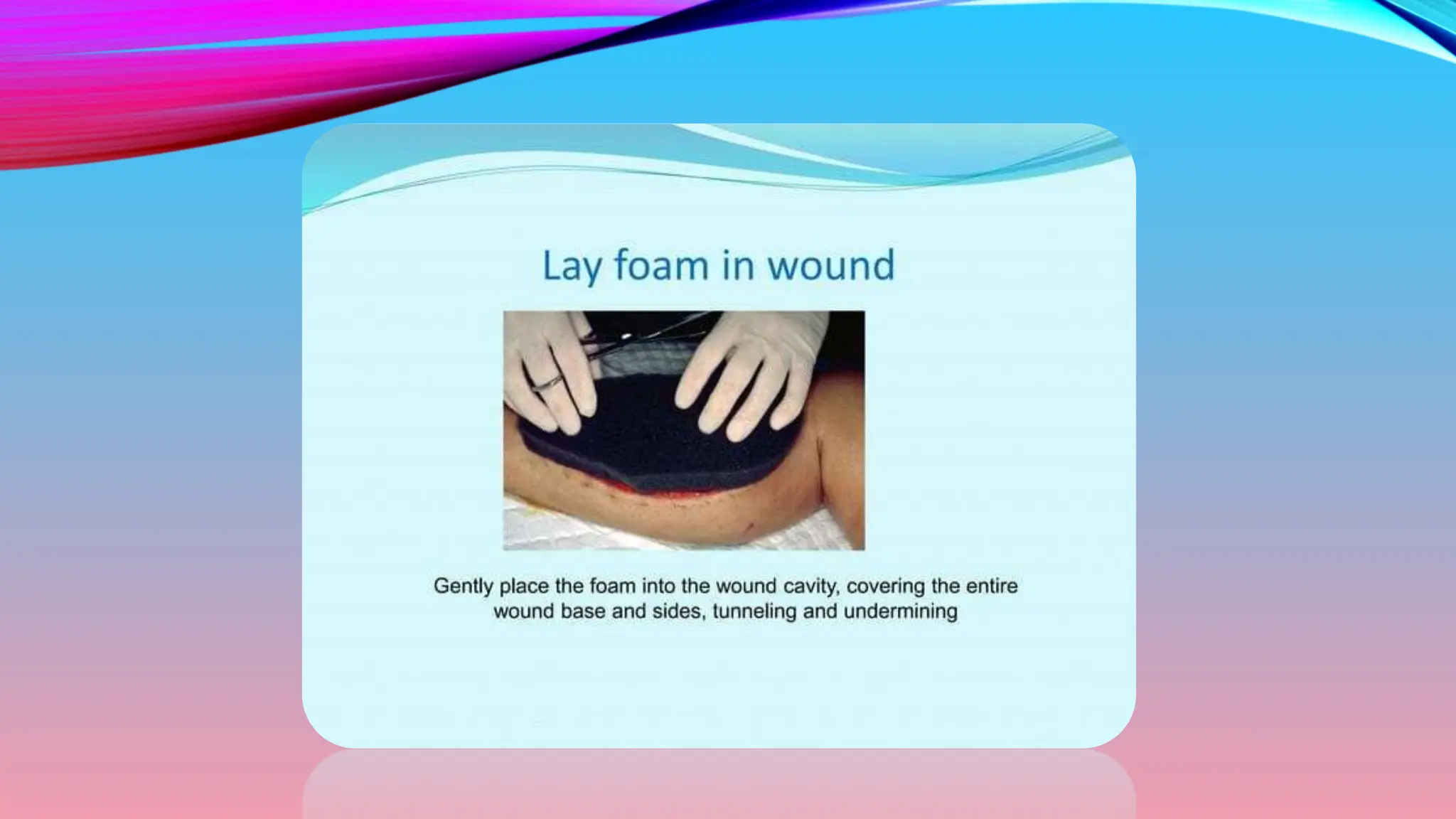 Vacuum asssited wound therapy for buns management | PPT
