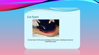 Vacuum asssited wound therapy for buns management | PPTX