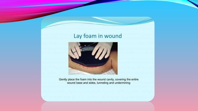 Vacuum asssited wound therapy for buns management | PPT