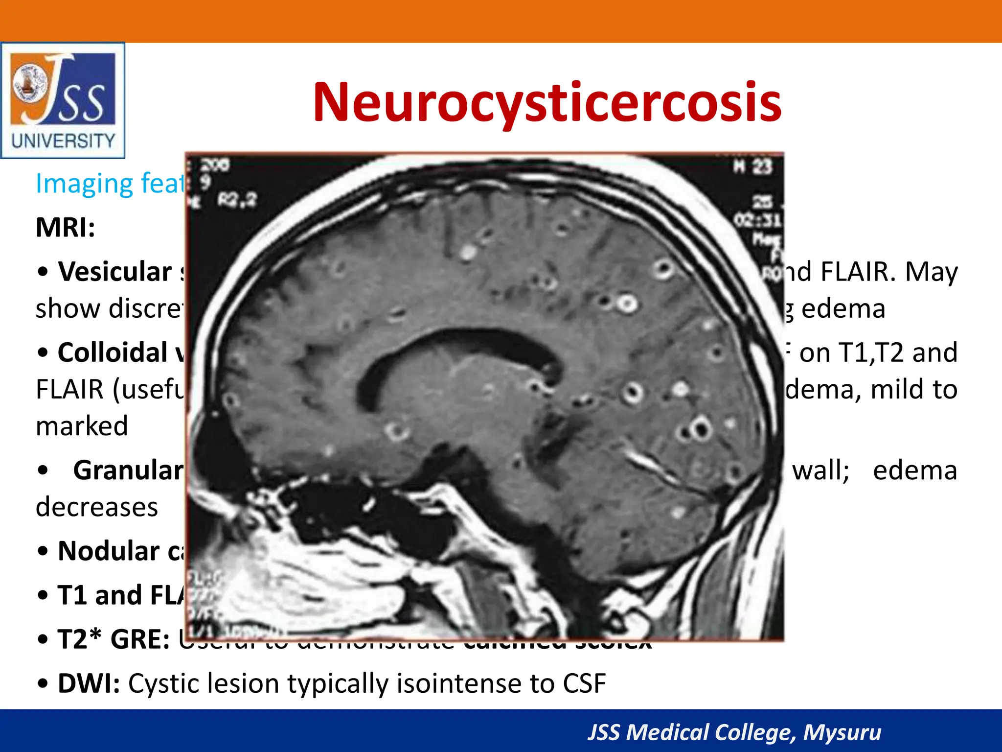 ring enhancing lesions¹111222222222111112 | PPT