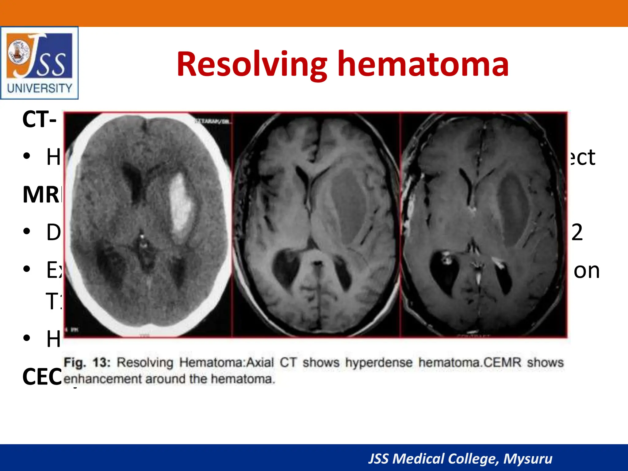 ring enhancing lesions¹111222222222111112 | PPT