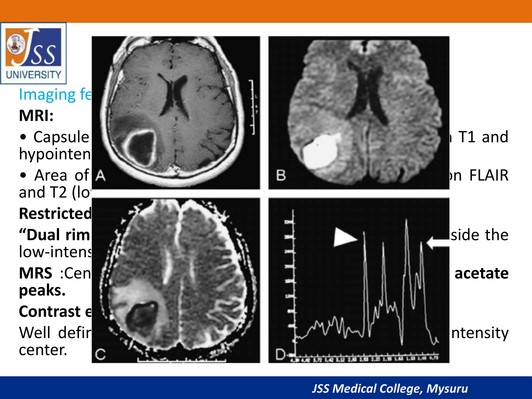 ring enhancing lesions¹111222222222111112 | PPT
