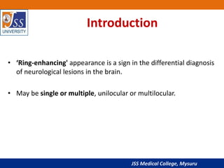 ring enhancing lesions¹111222222222111112 | PPT
