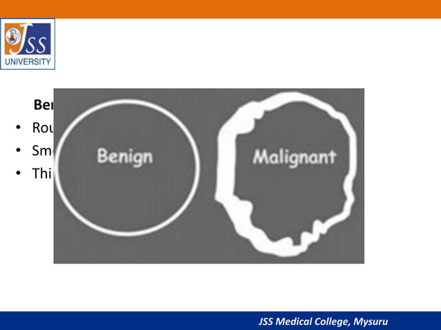 ring enhancing lesions¹111222222222111112 | PPT