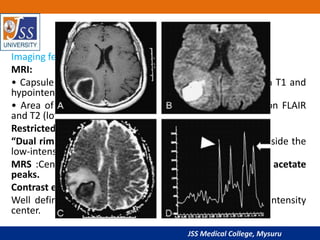 ring enhancing lesions¹111222222222111112 | PPT