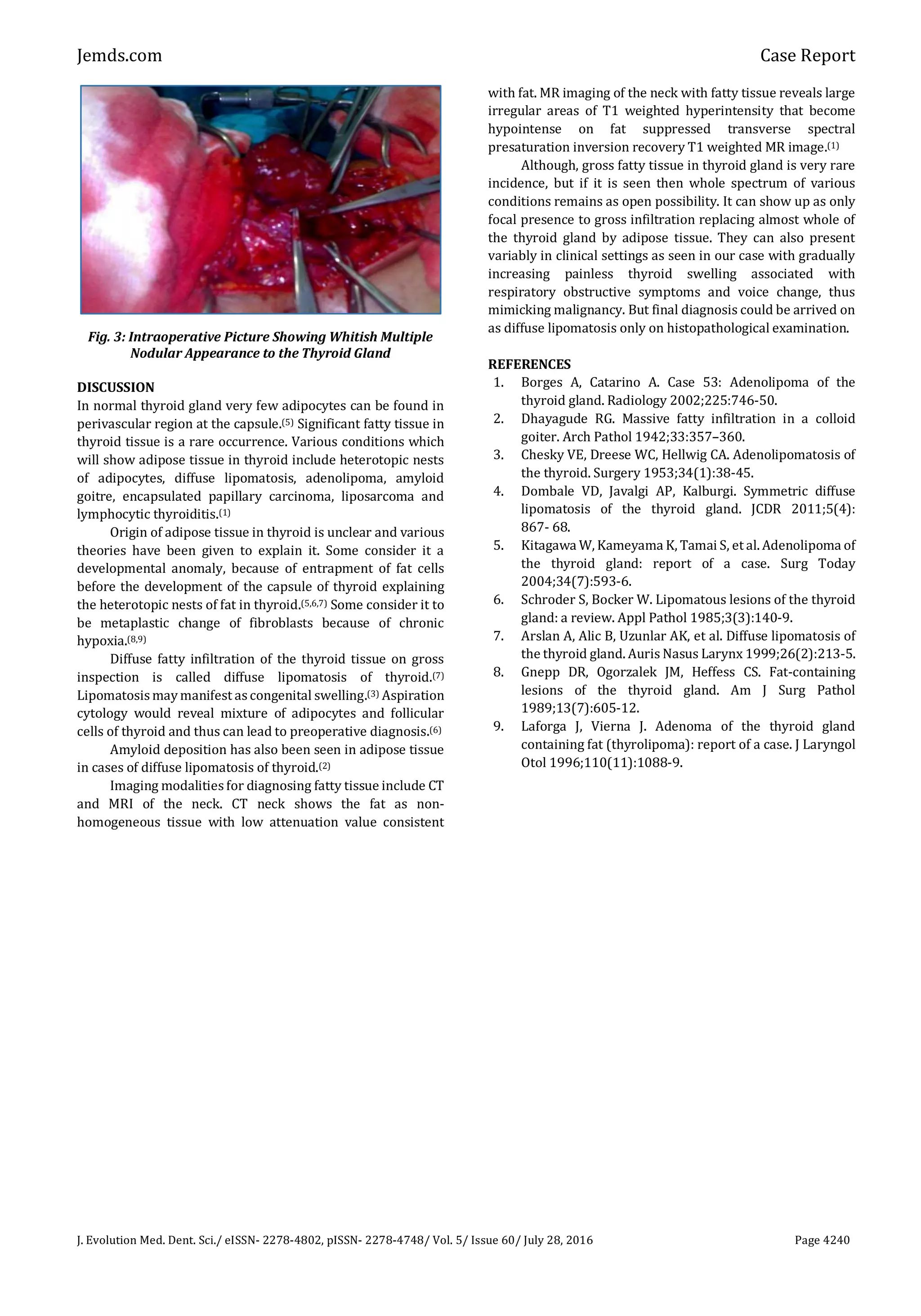 Diffuse Lipomatosis of Thyroid Gland Masquerading as Malignancy: A Case ...
