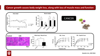 Musculoskeletal Complications of Cancer and its Treatments | PPTX