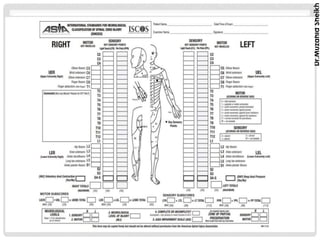 ASIA SCALE FOR SPINAL CORD INJURY ASSESSMENT | PPT