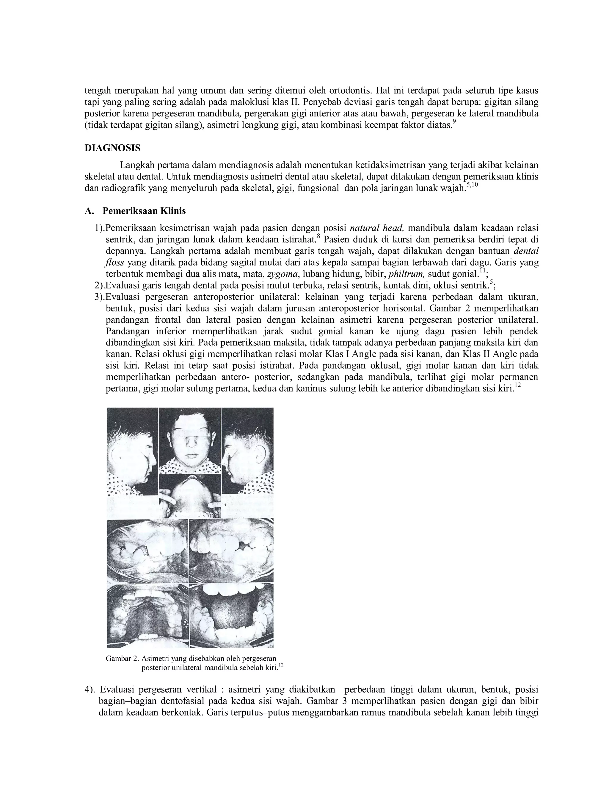 Asimetri dental dan wajah | PDF