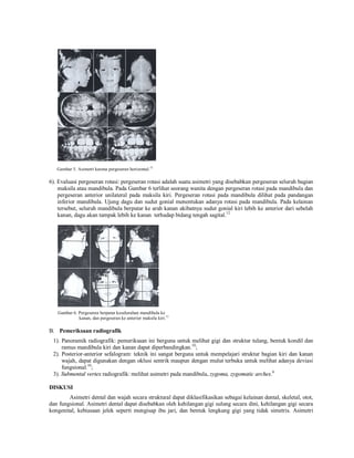 Asimetri dental dan wajah | PDF