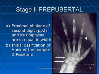 A simple method of growth prediction /certified fixed orthodontic ...