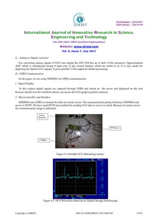 A simple portable ecg monitor with iot | PDF
