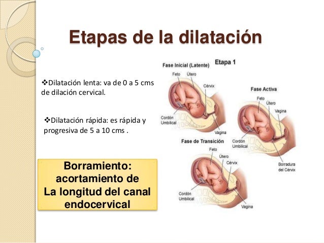Etapas del parto - Imagui