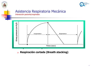 Asistencia Respiratoria Mecánica.ppt