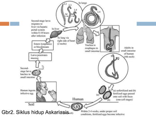 Askariasis | PPTX