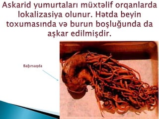 Askaridozun immun sistemə təsiri | PPTX