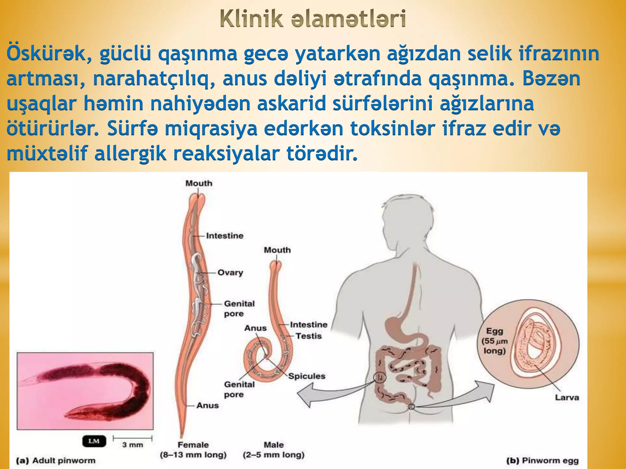 Askaridozun immun sistemə təsiri (2) | PPTX