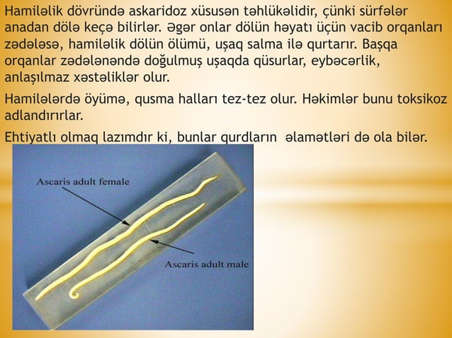 Askaridozun immun sistemə təsiri (2) | PPTX