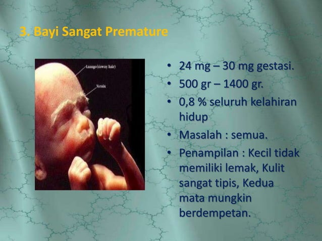 ASKEP-PADA-BAYI-PREMATUR.ppt