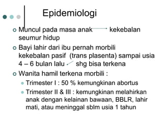 askep anak morbili.ppt