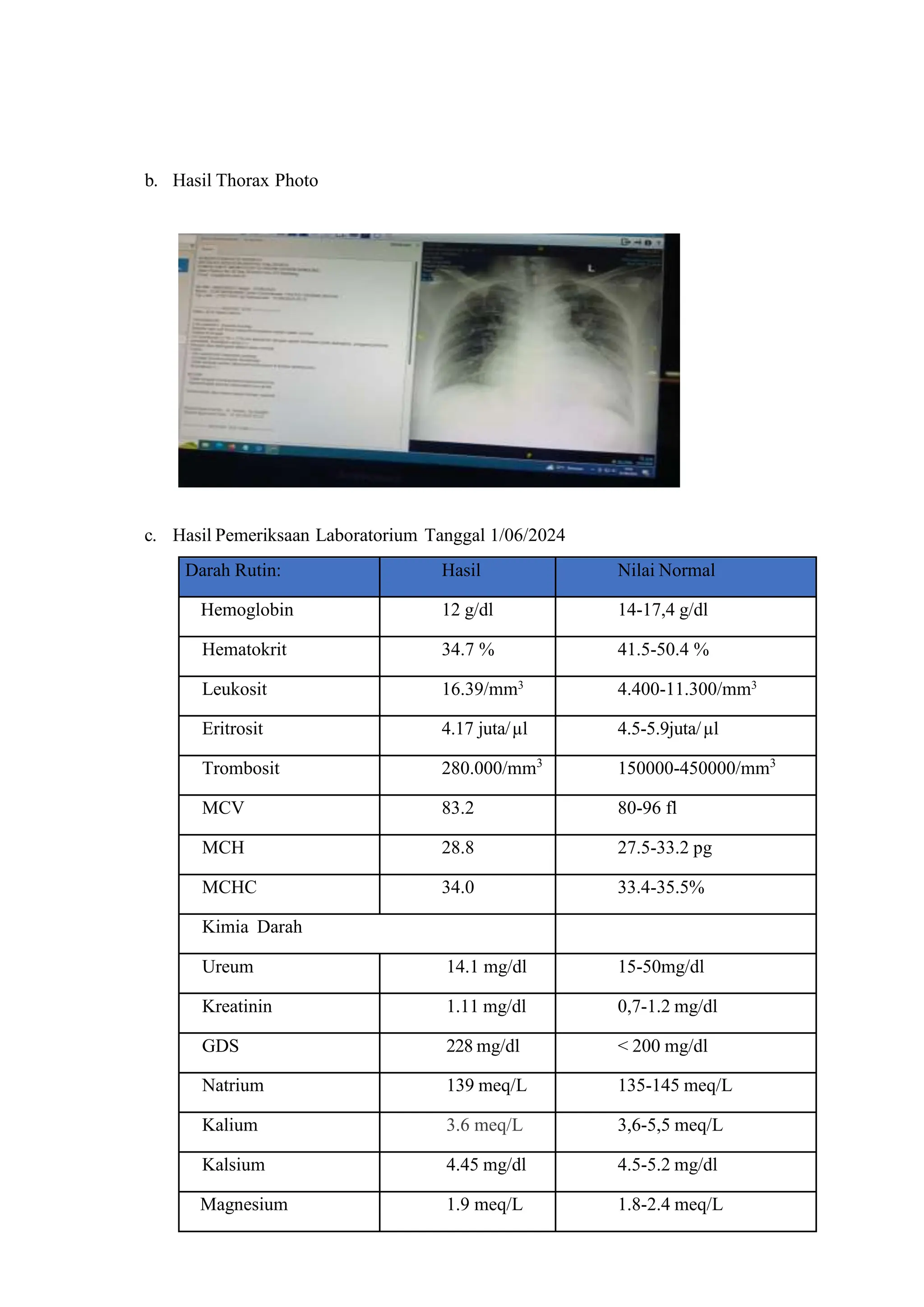 ASKEP Pada pasien dengan diagnosa CAD CICU.docx