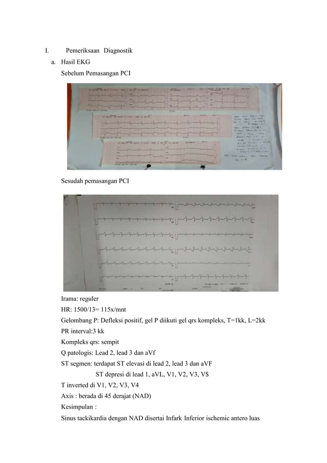 ASKEP pada pasien dengan diagnosa CAD CICU.docx