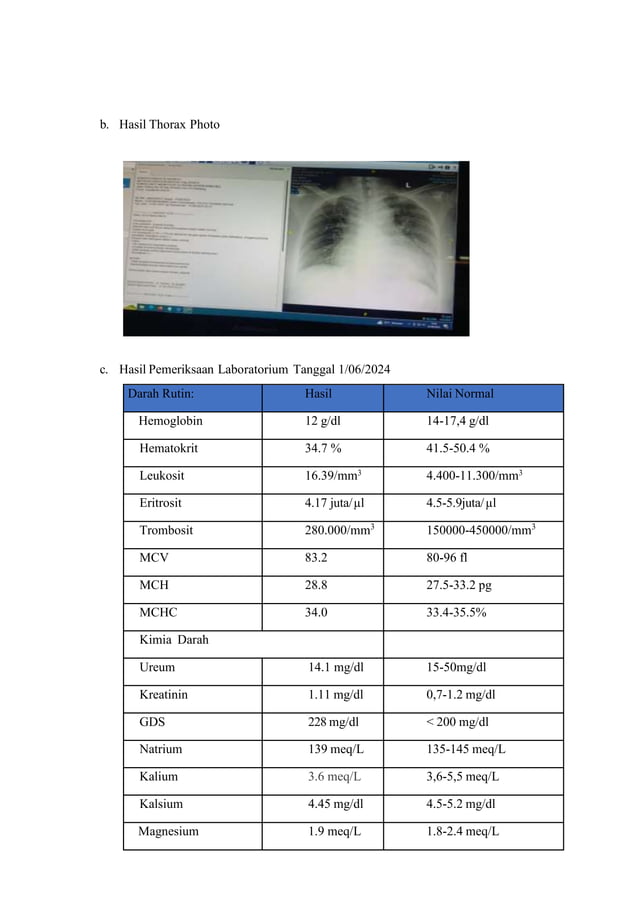 ASKEP pada pasien dengan diagnosa CAD CICU.docx