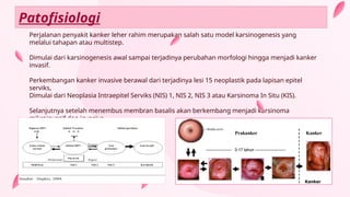Asuhn keperawatan pada wanita dengan gg kanker servpptx | PPTX