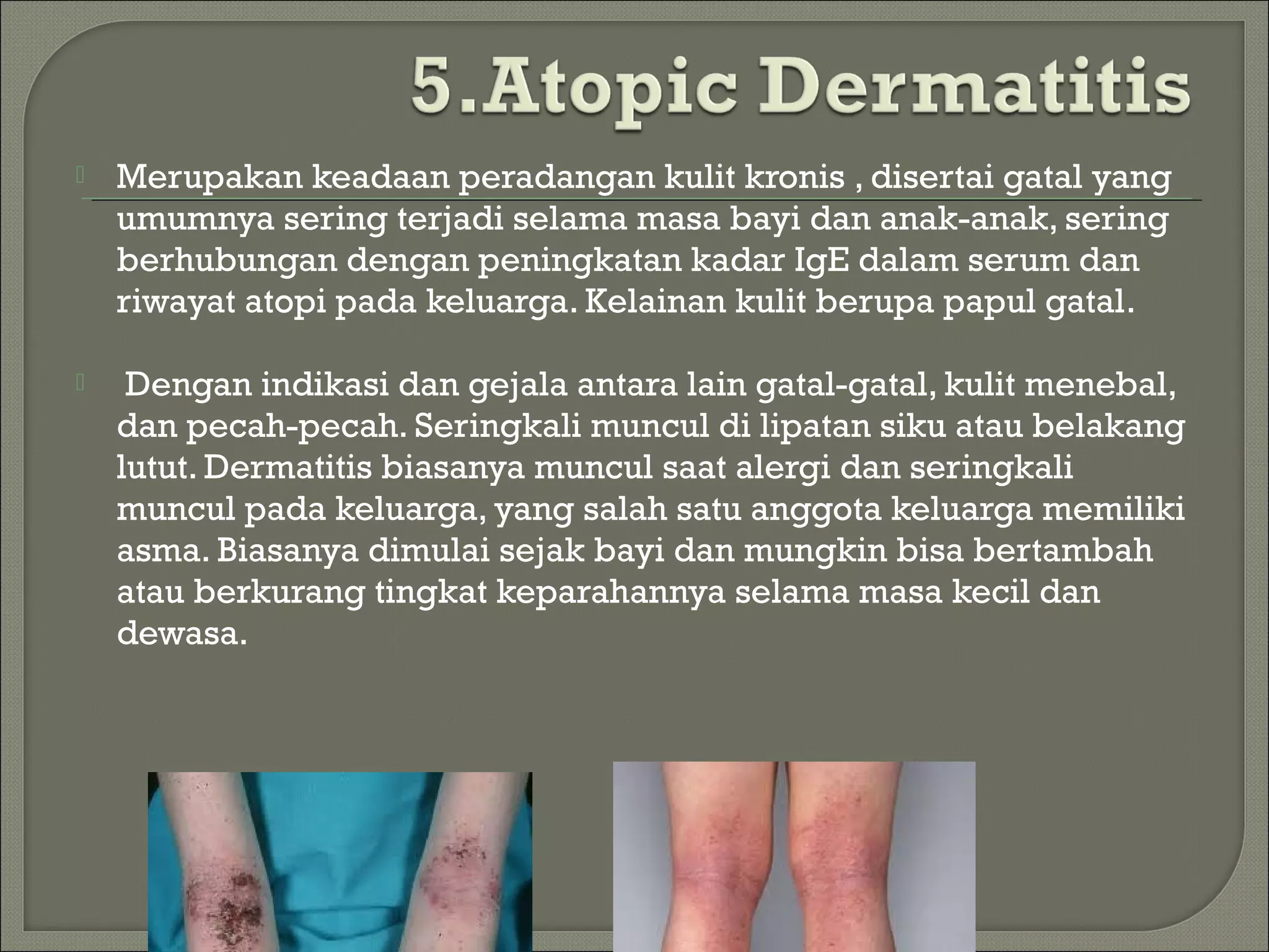 Askep dermatitis | PPT