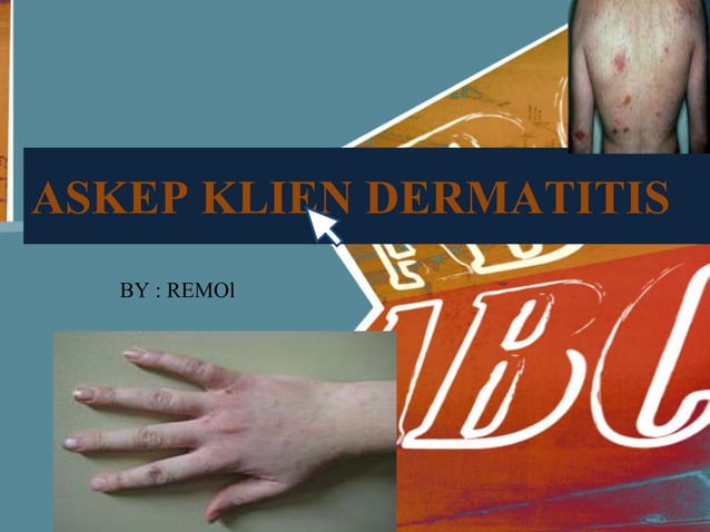 Askep dermatitis | PPTX