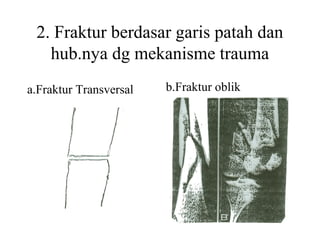 Askep fraktur | PPT