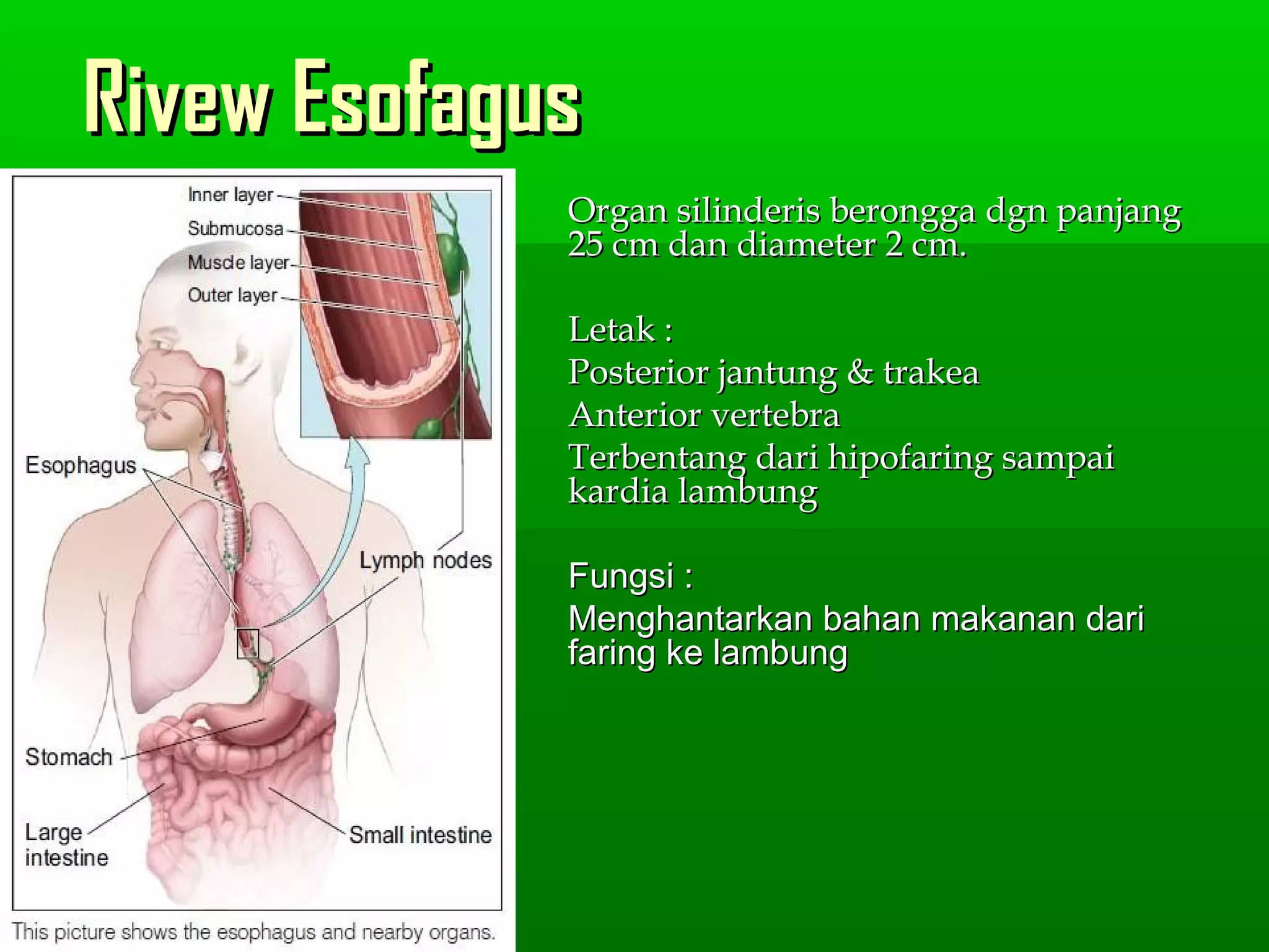 Askep ggn esofagus | PPT