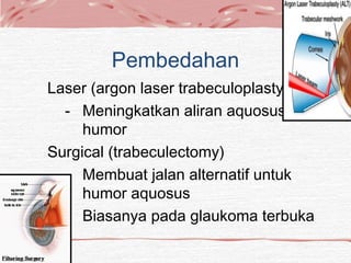 Askep glaukoma | PPT