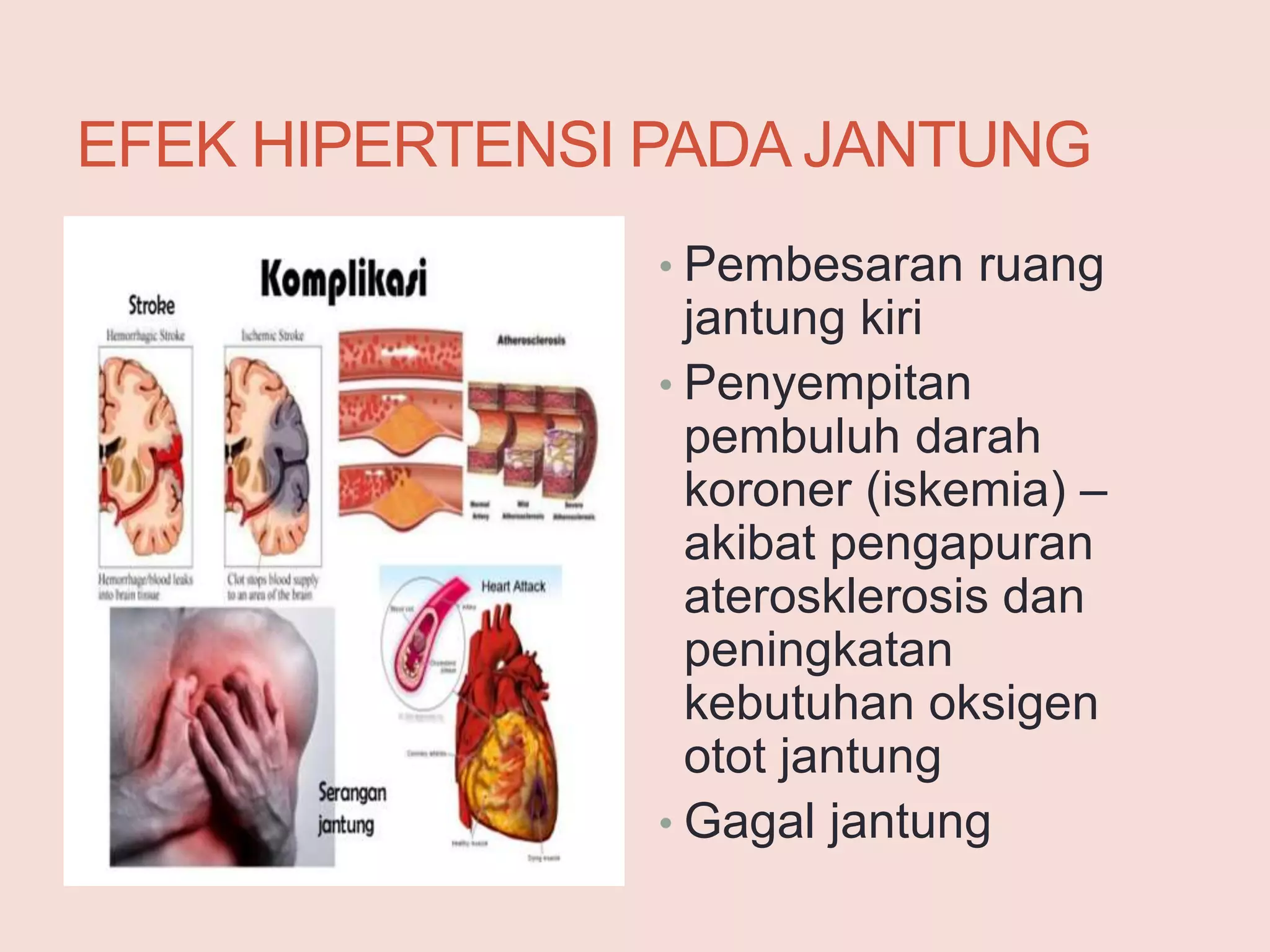 Askep_Hipertensi.ppt
