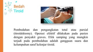 ASKEP Hipertiroid Kel 2 Konversi S1 STIKES ABB.pptx