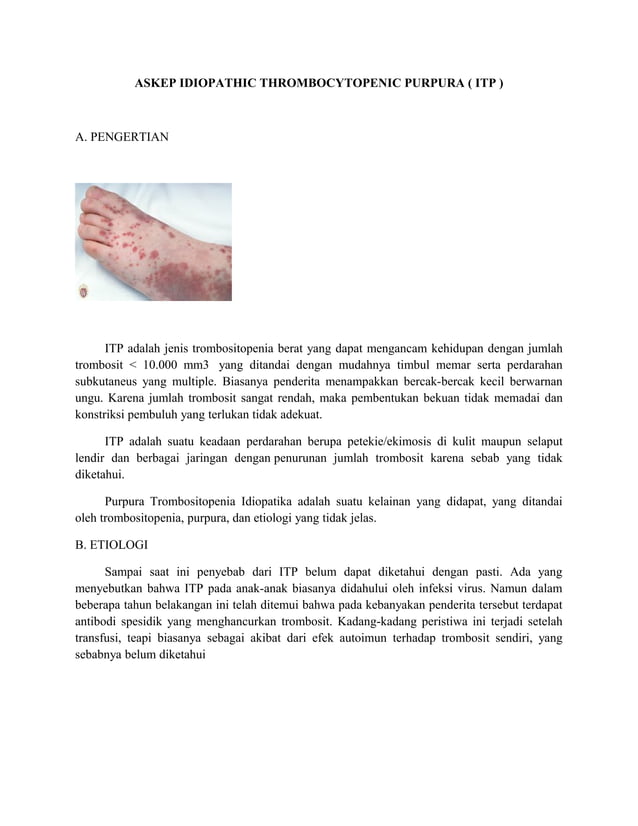 Askep idiopathic thrombocytopenic purpura | DOC
