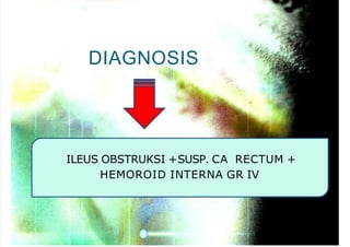 Askep Ileus Obstruksi.pdf