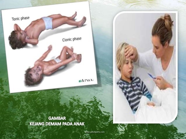Askep kejang dan demam pada anak | PPTX