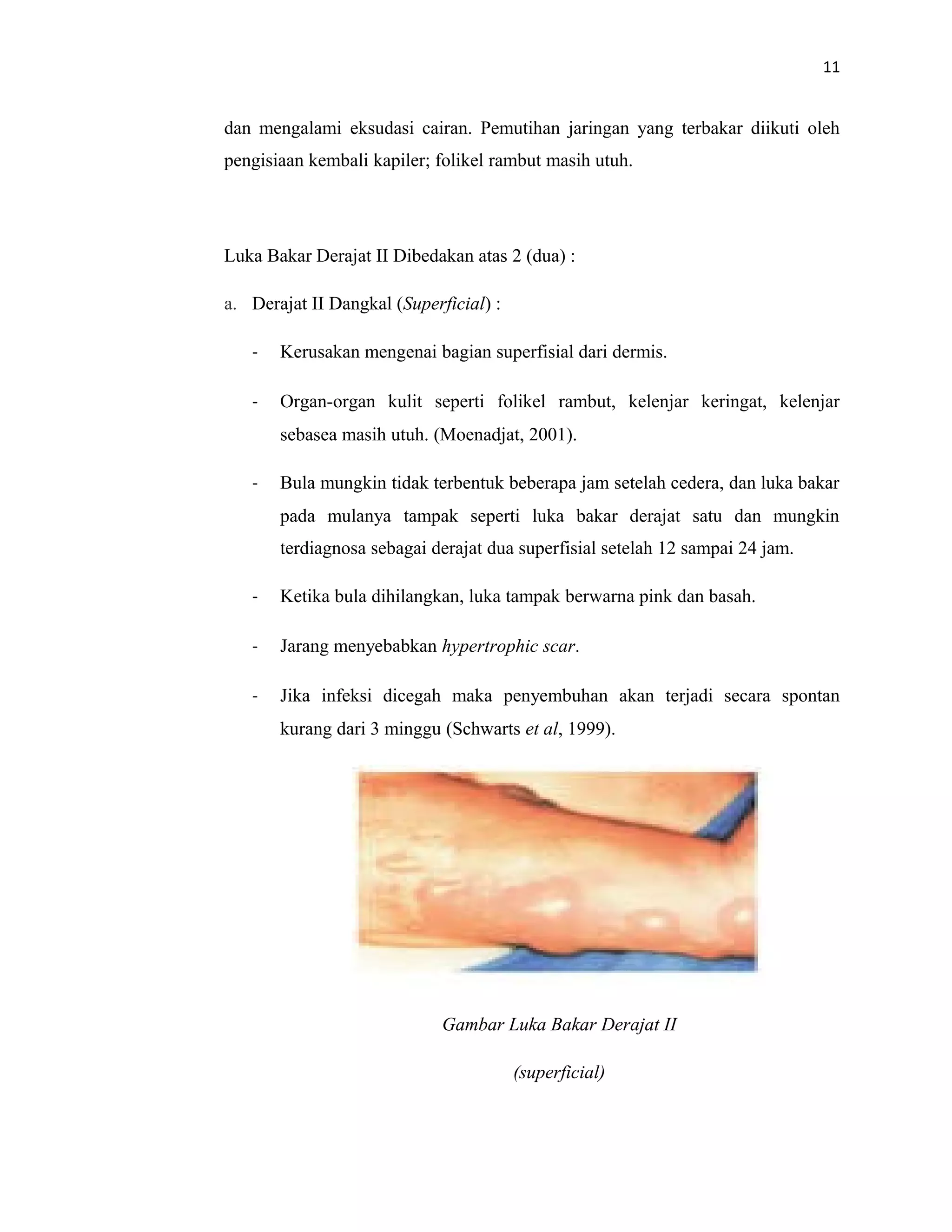 Askep luka bakar asli | DOC