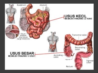 Askep obstruksi usus | PPT