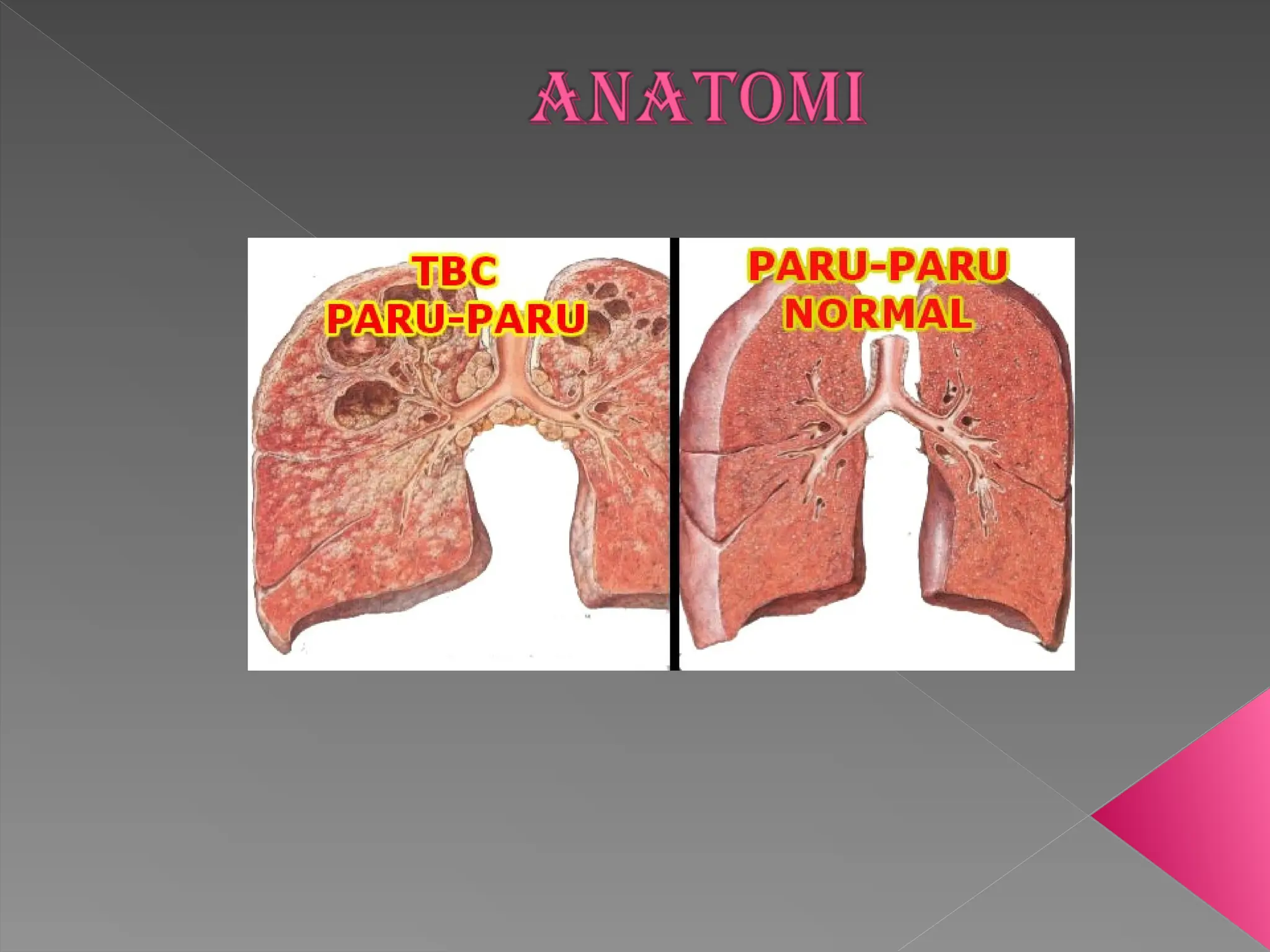 ASKEP TB PARU........................... | PPT