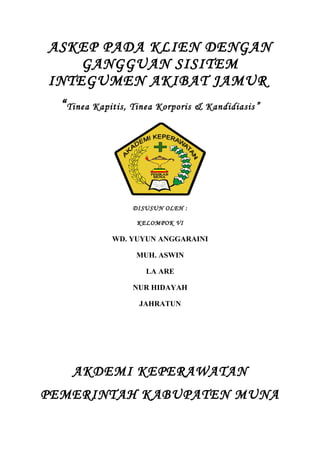 Askep tinea kapitis AKPER PEMKAB MUNA | PDF