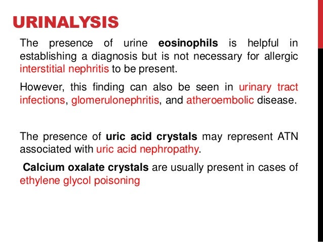 ACUTE KIDNEY INJURY AKI laboratory investigation